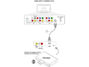 How to connect the HDMI accessory device to my Philips TV? | Philips