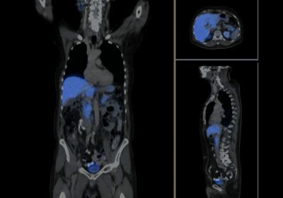 Explore the Philips products