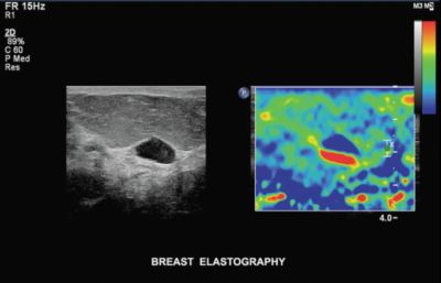 Ver detalles de Philips - US Q-App Elastography Quantification (EQ)*