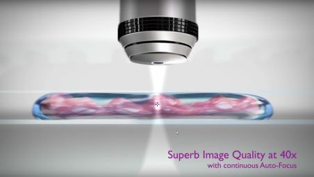 Ultra Fast Scanner Digital pathology slide scanner | Philips Healthcare