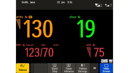 Avalon beltless fetal monitoring solution Cableless fetal and maternal ...