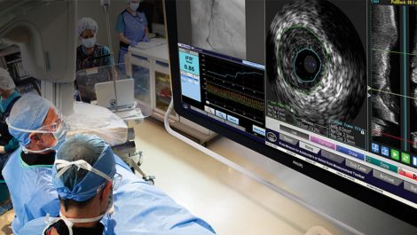 Core Precision guided therapy system | Philips Healthcare