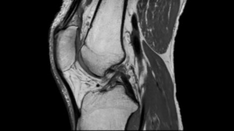 3D MSK VIEW | Philips