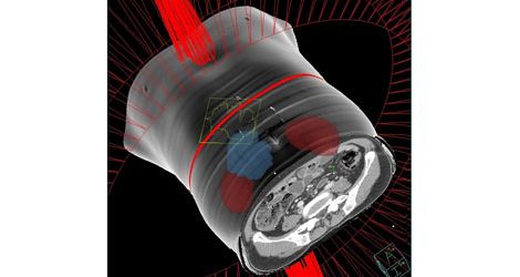 Afficher les détails de Philips Pinnacle³ SmartArc