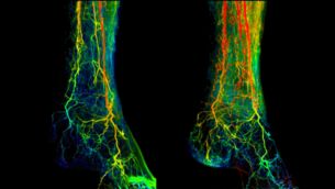 介入放射学_介入 X 射线造影成像系统 | 飞利浦医疗