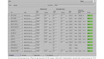 查看 Philips Pinnacle³ 评分卡可简化并规范计划审批流程 HCNOCTN362 的详细信息