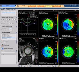 View details of Philips Cardiac Explorer