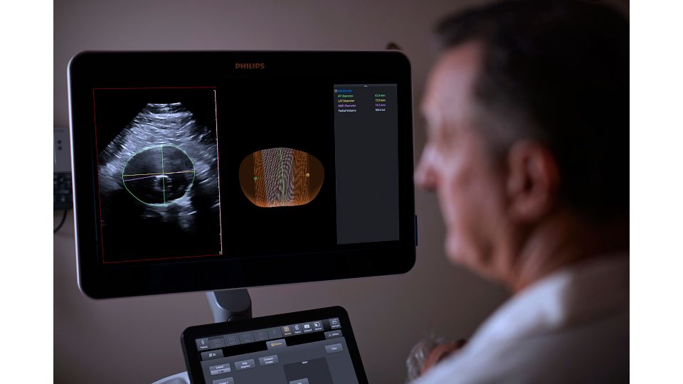Philips Access CT, with a pediatric patient - Media library | Philips