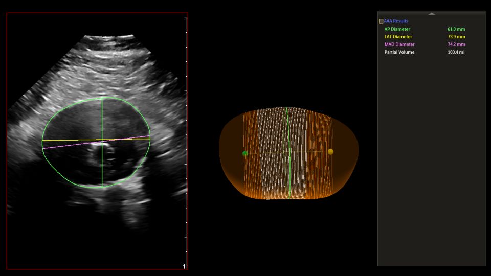 Philips Access CT, with a pediatric patient - Media library | Philips