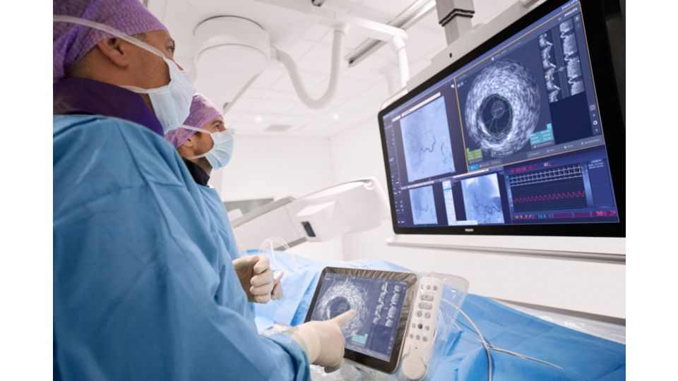 Philips’ KODEX-EPD dielectric imaging and navigation system - Media ...