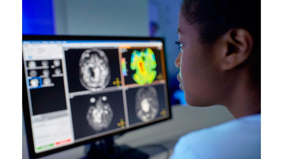 Philips DigitalDiagnost C90 - Media library | Philips