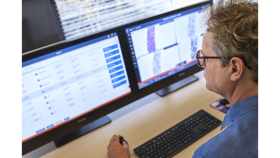 Philips IntelliSite Pathology Solution's Ultra Fast Scanner - Media ...