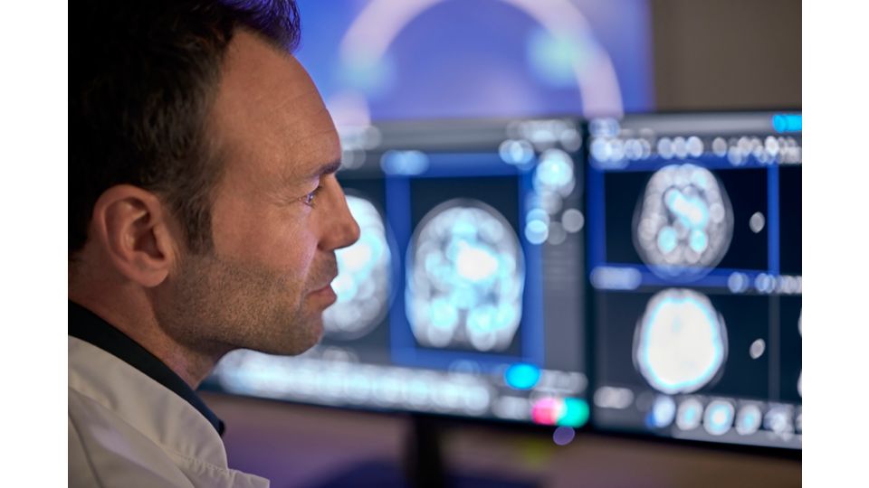 Philips Vue PACS for 3 screen view - Media library | Philips