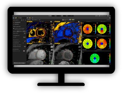 Philips - MR Cardiac Quantitative Mapping - Philips