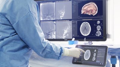 Philips - SmartCT Soft Tissue Helical - Neuro imaging technology
