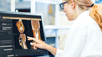 Pinnacle Dynamic Planning Image Registration | Philips