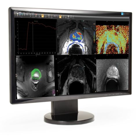 DynaCAD Prostate Advanced visualization for prostate MRI analysis ...