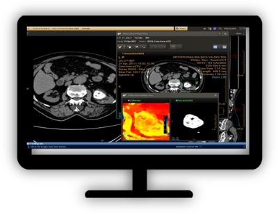 Philips - CT Spectral Light Magic Glass