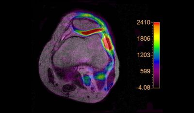 Philips - Multi Nuclei - MSK HCNMRF430B