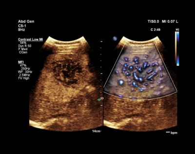 MicroFlow Imaging – Products & Services - Philips
