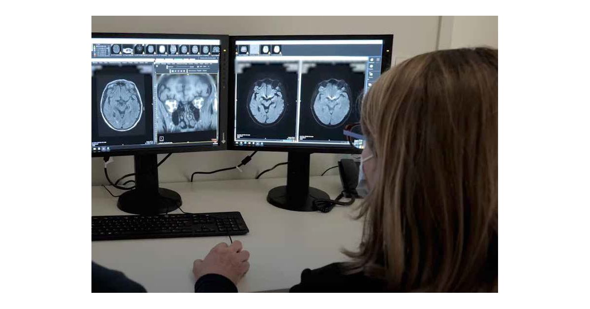 Saint-Augustin verhoogt de MRI-capaciteit - Philips