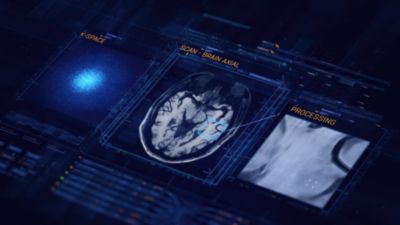 Increased diagnostic confidence with AI - Philips