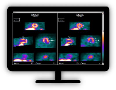 Philips - NM Emory Cardiac Toolbox (ECTb)