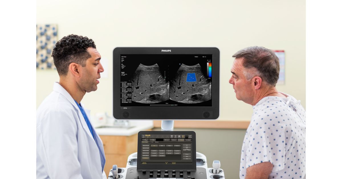 Shear wave elastography - Philips