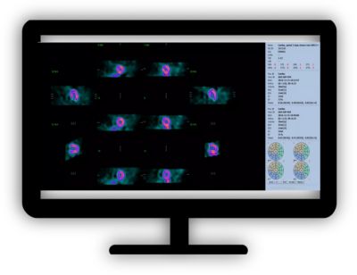 Philips – NM Cedars-Sinai Cardiac Suite v2017.22