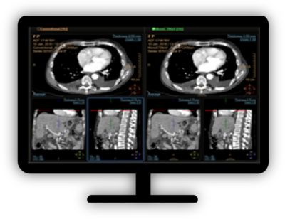 Philips - CT Spectral Magic Glass on PACS