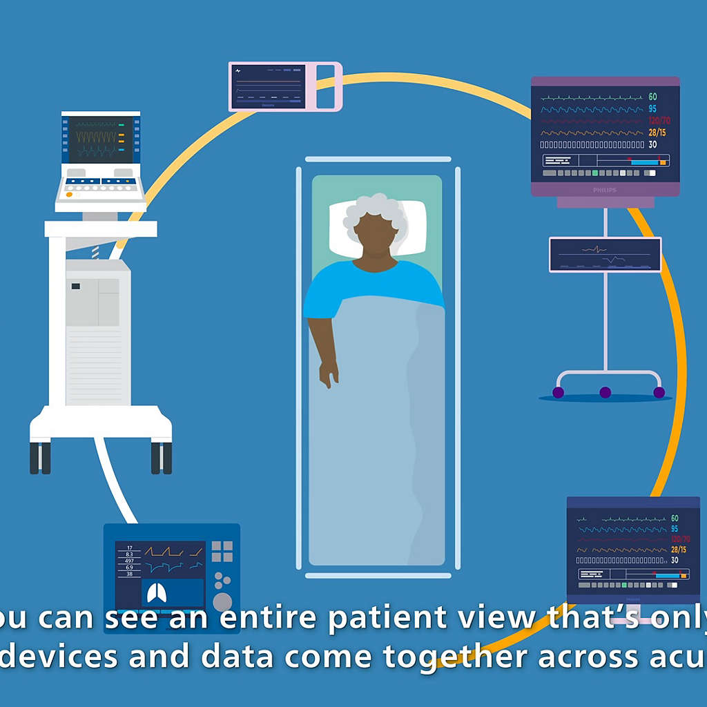 Central patient monitoring systems - Philips Central patient monitoring systems - Philips