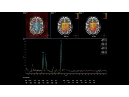 Philips - Spectroscopy - Brain MR Clinical application