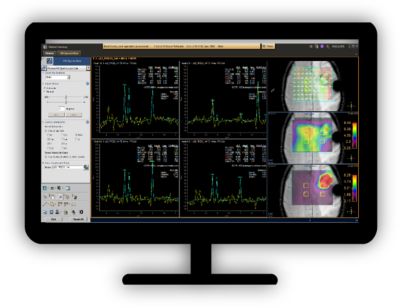 Philips - MR SpectroView Review metabolite maps