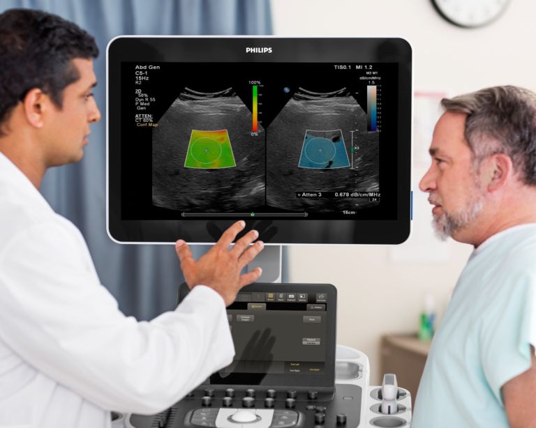 Ultrasound systems and software - Philips
