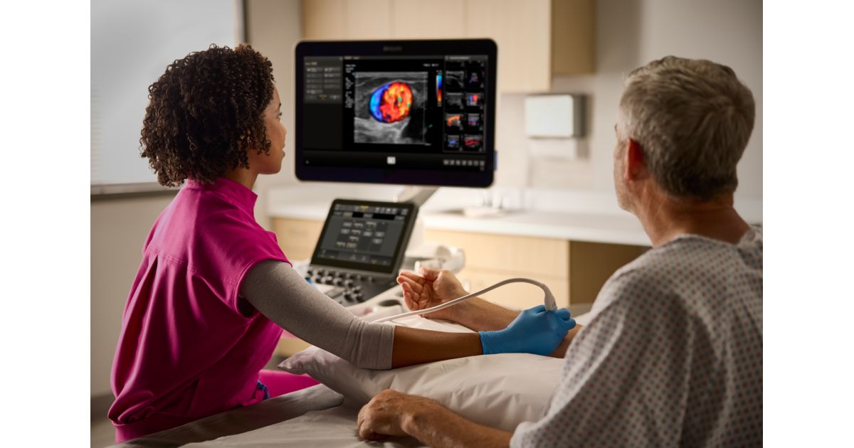 General imaging ultrasound - Philips