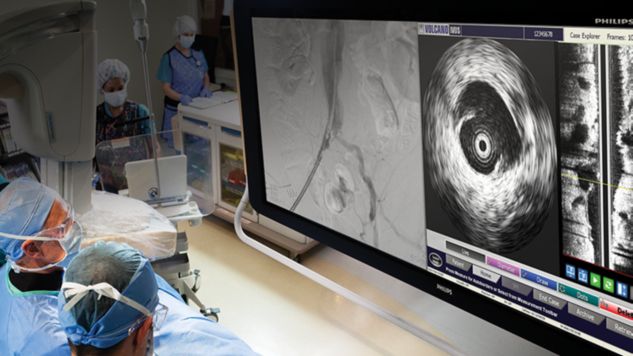 Philips Volcano - Core Mobile Precision guided therapy system