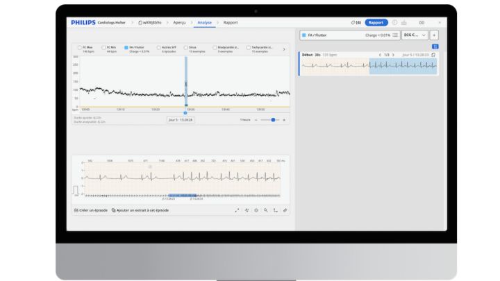 Cardiologs Holter - Philips