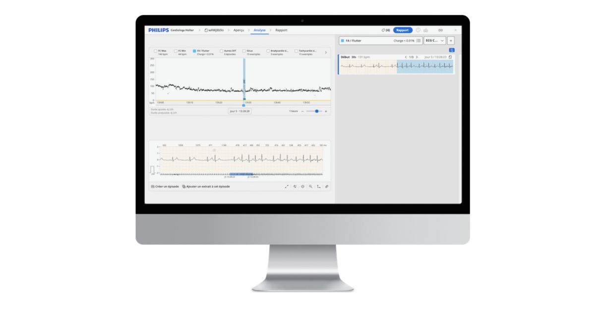 Cardiologs Holter - Philips