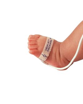 Philips - Neonatal Disposable SpO2 Sensor - 24/case 24/case Sensor