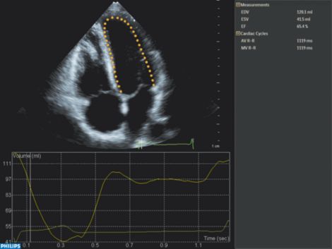 Philips - IntelliSpace Portal 8.0