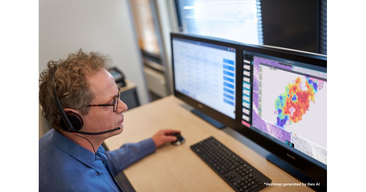 Digital pathology - Philips