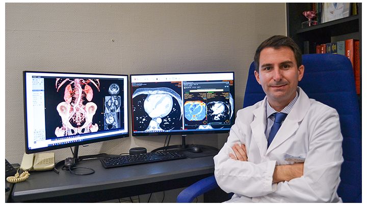 Advanced Visualization Workspace for cardiac analysis - Philips