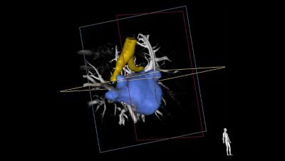 Philips - EP navigator