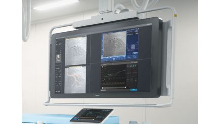 Philips - SyncVision precision guidance system