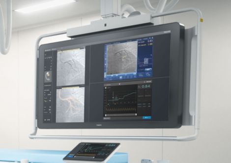 SyncVision Precision guidance system | Philips Healthcare