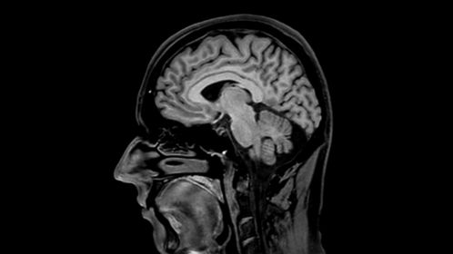 Brain Mri Scan 3d