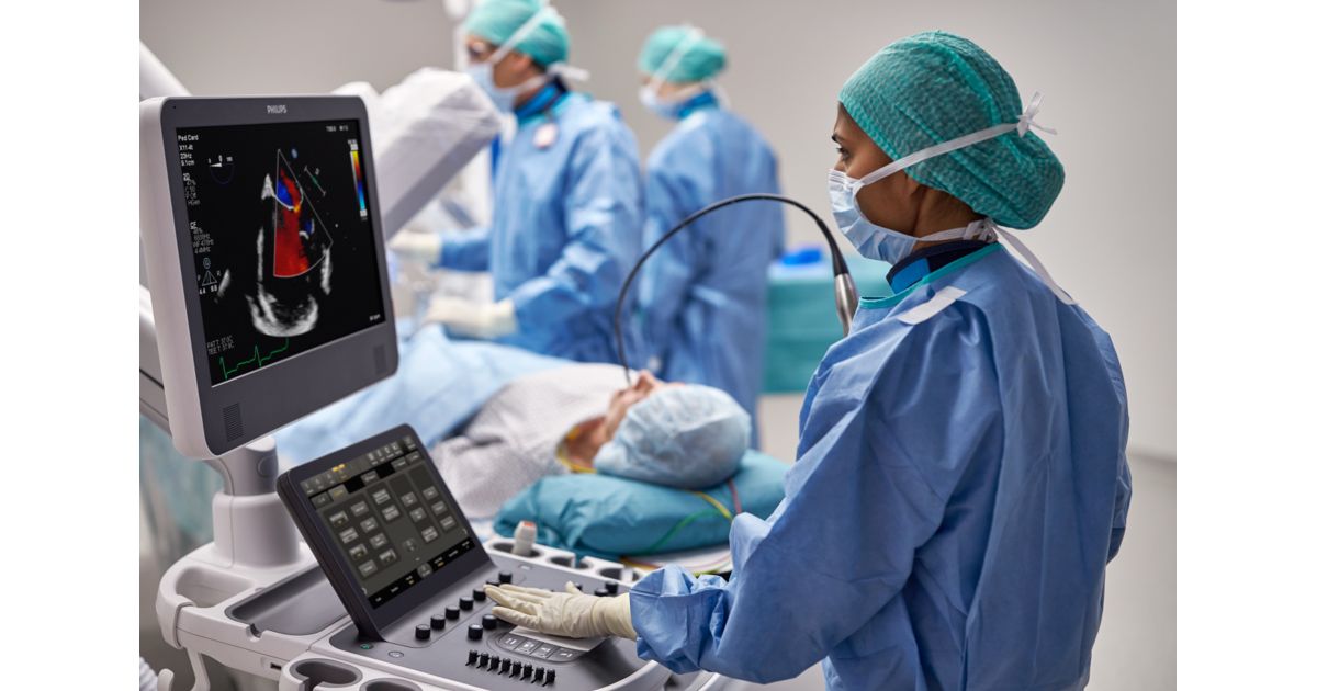 Ultrasound - Philips