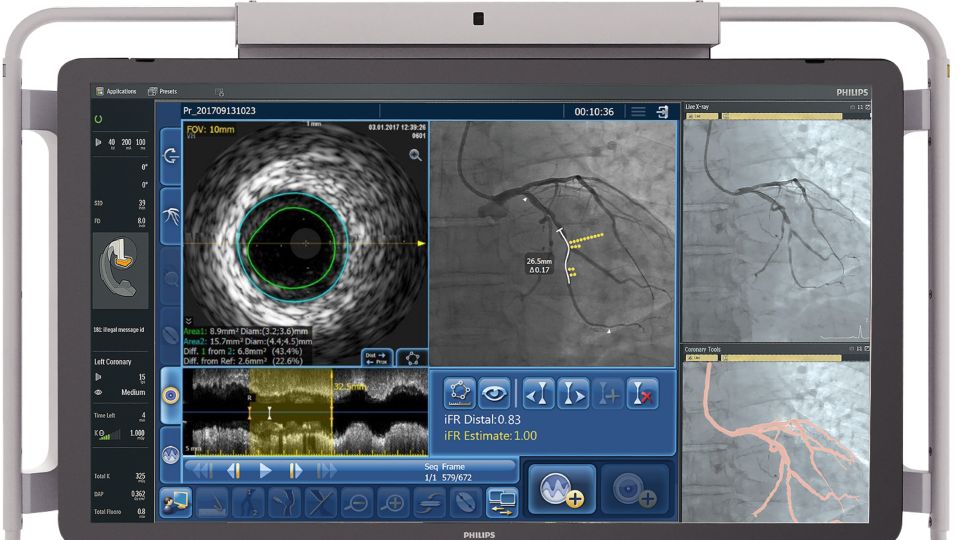 Philips suite of solutions for coronary health - Philips