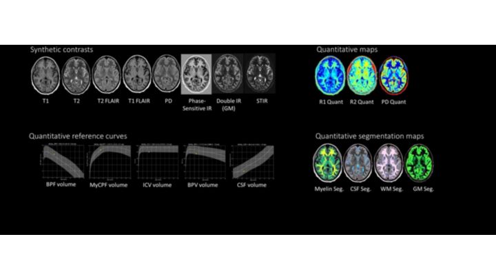 New standards in neuro MR quantification - Philips