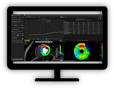 Philips - MR Cardiac Temporal Enhancement (Perfusion)